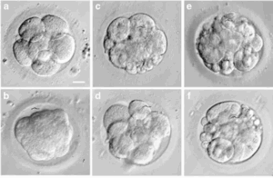 Embryo Grading Explained: What It Means for Your IVF Cycle