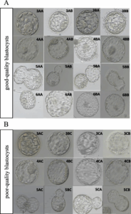 Embryo Grading Explained: What It Means for Your IVF Cycle
