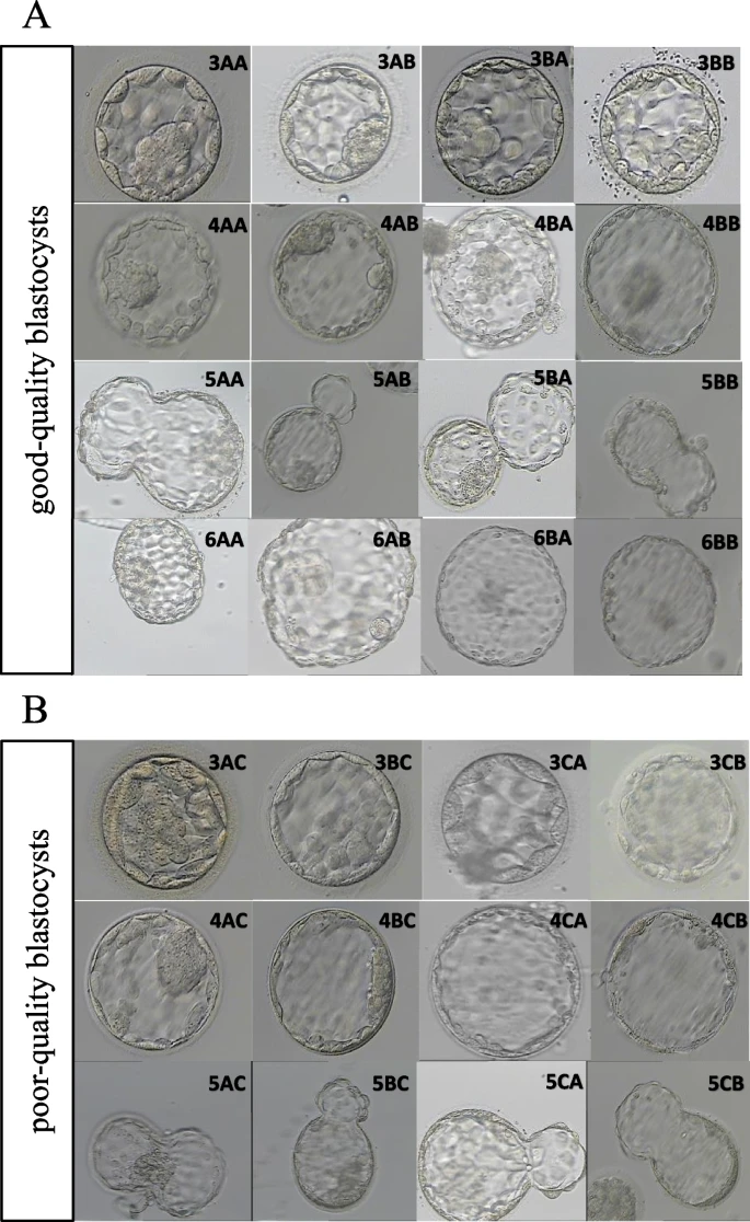 Embryo Grading Explained: What It Means for Your IVF Cycle